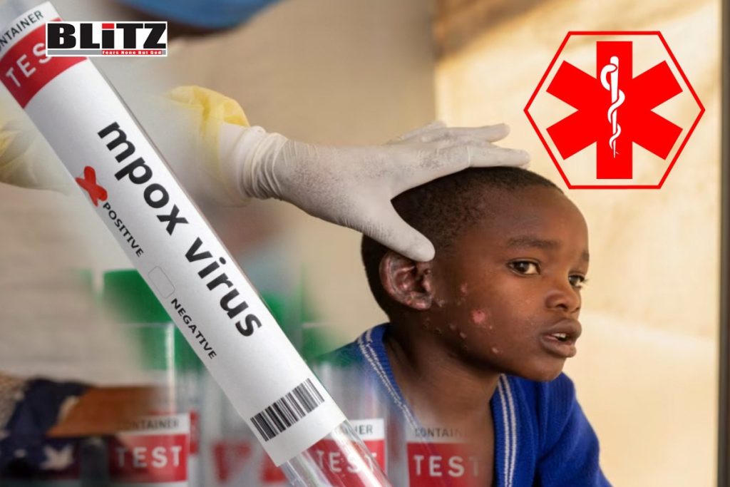 New Mpox strain sparks global health emergency - BLiTZ